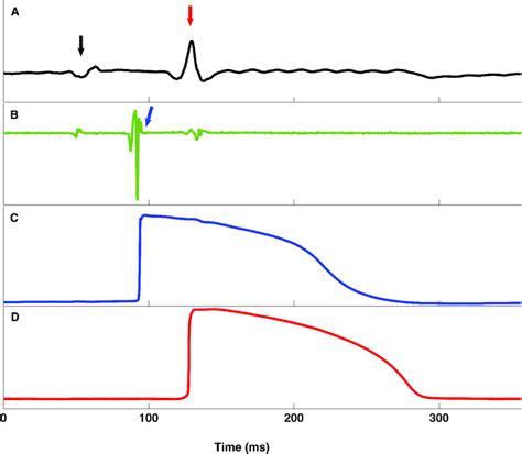 Example Of The Pseudo Ecg A Bipolar Electrogram B And Download Scientific Diagram