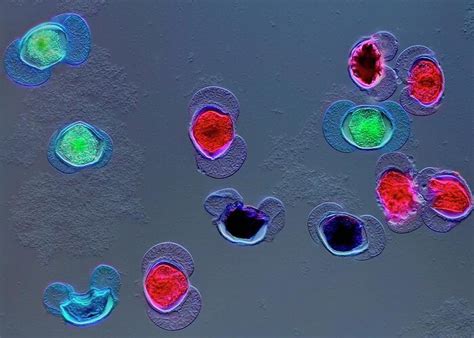 Pine Pollen Microscope