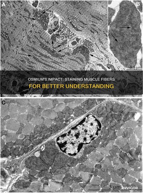 Osmiums Impact Staining Muscle Fibers For Better Understanding Cyvigor