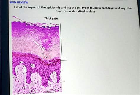 Solved Skin Review Label The Layers Of The Epidermis And List The Cell