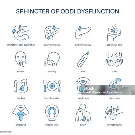 Sphincter Of Oddi Dysfunction Symptoms Diagnostic And Treatment Vector