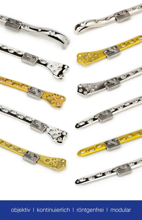 Bluetooth Fracture Monitoring Does This Mean I Can Now Start Worrying Less About Cat Tibial