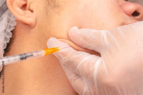 Masseter Jaw Botox Also Known As Jawtox Procedure Close Up View Of A Medical Professional Or
