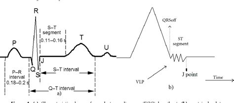 Figure 1 From Efficient Detection Of Ventricular Late Potentials On Ecg Signals Based On Wavelet