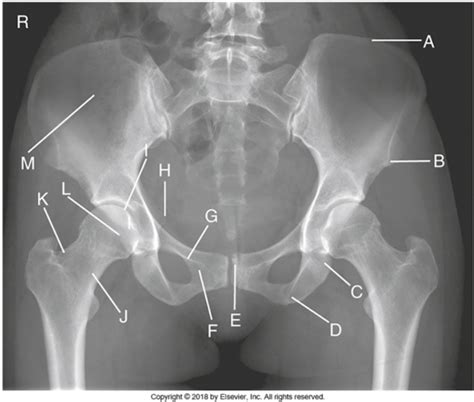 Ap X Ray Pelvis Labeling Diagram Quizlet