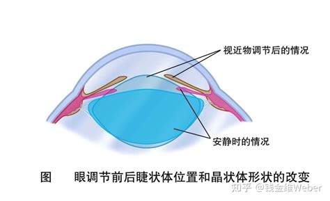 请问高度近视的户外时间，白天好还是晚上好啊？ 知乎