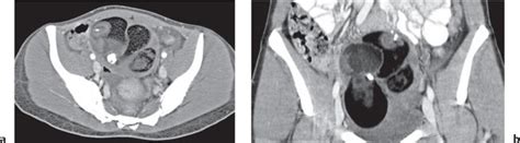 29 Pelvis Radiology Key
