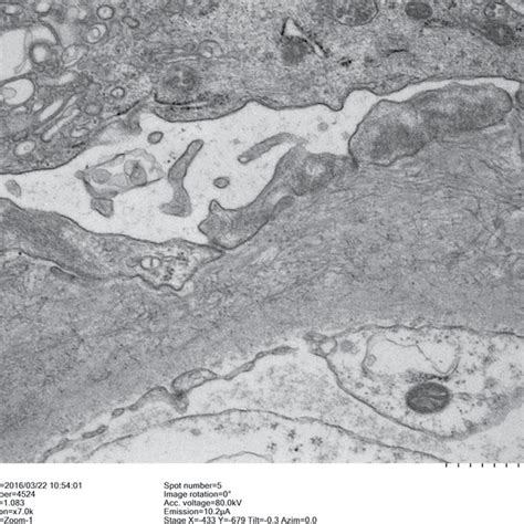 Transmission Electron Microscopy Of Glomerular Basement Membrane With