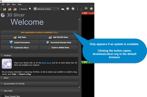 add check for available application updates by lassoan · pull request
