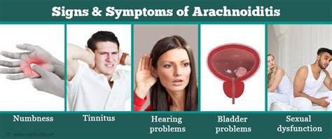 Arachnoiditis Types Causes Symptoms Risk Factors Diagnosis