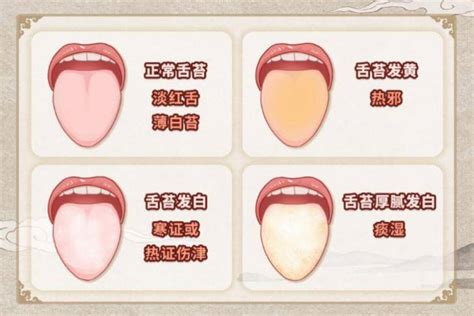 舌象揭秘：点刺、裂纹、舌头短缩、舌苔变化，你的舌头在说什么？ 科普新疆新疆本地化科普资源共享开放平台