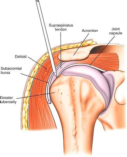 The Forearm Teachme Orthopedics
