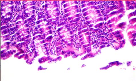 Microtomy Demonstration Flashcards Quizlet