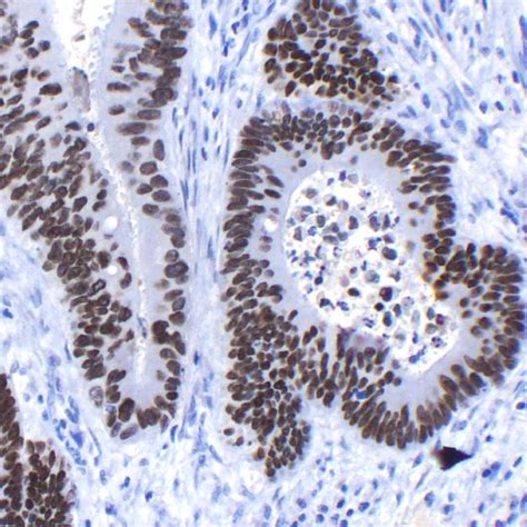 Satb2 Prm111 Pathnsitu Biotechnologies