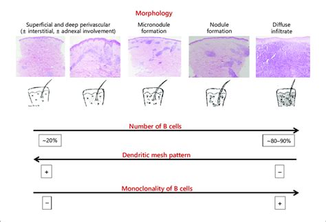 Suggested Diagrammatic Scheme Of The Life Of Lesion Of Primary Download Scientific Diagram