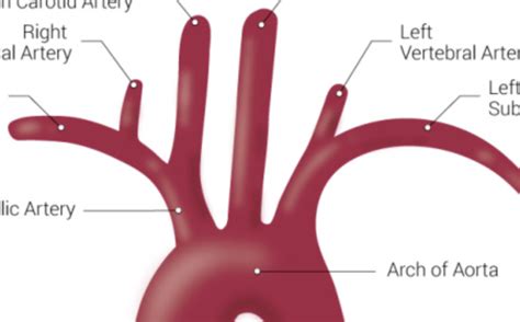 Aortic Arch Diagram Quizlet
