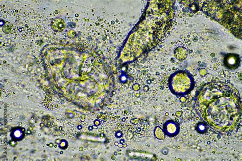 Green Mucus And Coughing Up Phlegm Under The Microscope Looking At