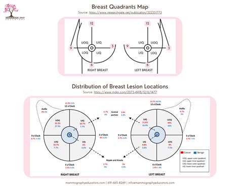 Breast Quadrant Map And Distribution Of Breast Lesion Locations