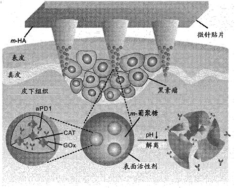 Enhanced Cancer Immunotherapy By Microneedle Patch Assisted Delivery Eureka Patsnap