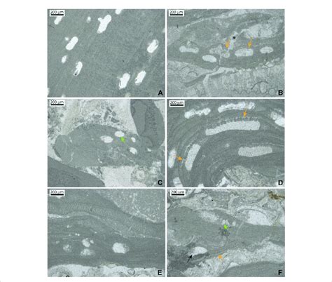 Micrographs Of Selected Taxa In The Coralline Algal Assemblages In The