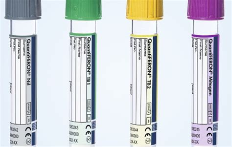 Tìm Hiểu Tb Skin Test Là Gì Và Vai Trò Của Nó Trong Chẩn đoán Các Bệnh Lý Da