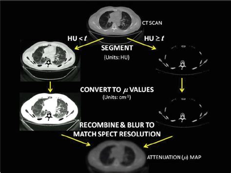 The Steps Involved In Converting From A Ct Scan To Linear Attenuation