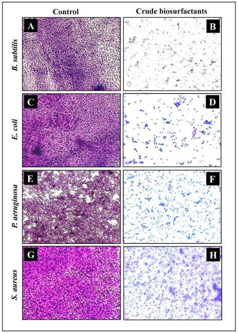 Functional And Structural Characterization Of Pediococcus Pentosaceus