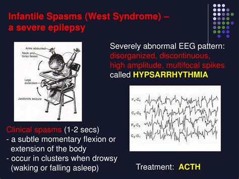 Ppt Pediatric Neurology Review Powerpoint Presentation Free Download