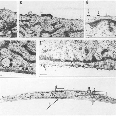Conventional Transmission Electron Micrograph Of An A1 F Human Skin