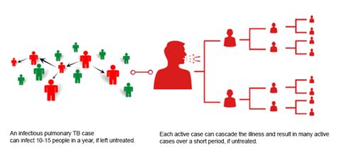 Exposure To Tuberculosis Bacilli And Risk Of Infection Knowledge Base