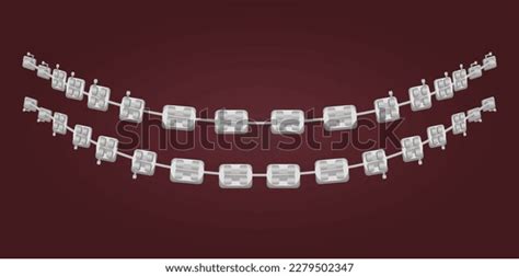Concept Teeth Alignment Braces Orthodontic Dentistry Stock Vector Royalty Free 2279502347