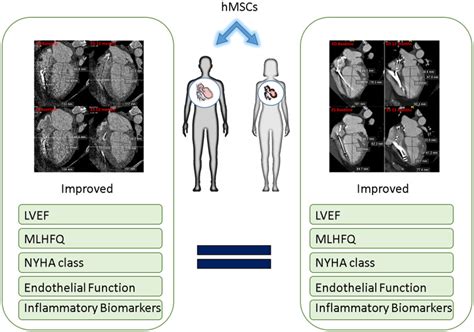 The Impact Of Patient Sex On The Response To Intramyocardial