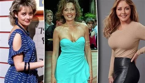 Carol Vorderman Plastic Surgery A Closer Look