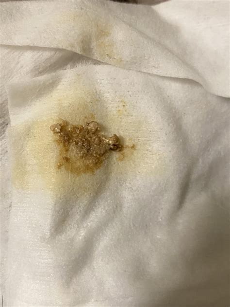 Anal Gland Discharge Is This Normal Or Concerning R Vet