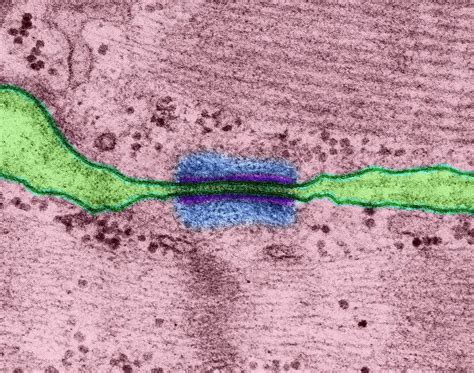 Desmosomes In Cardiac Muscle Cells