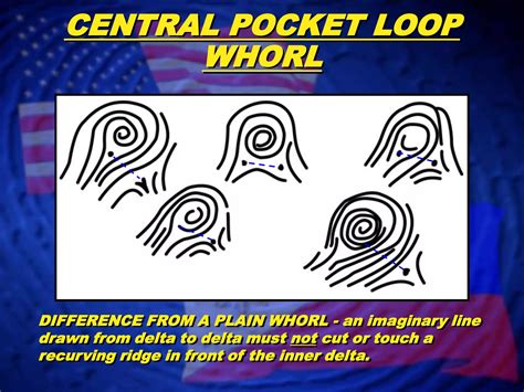 Whorl Patterns Pptx