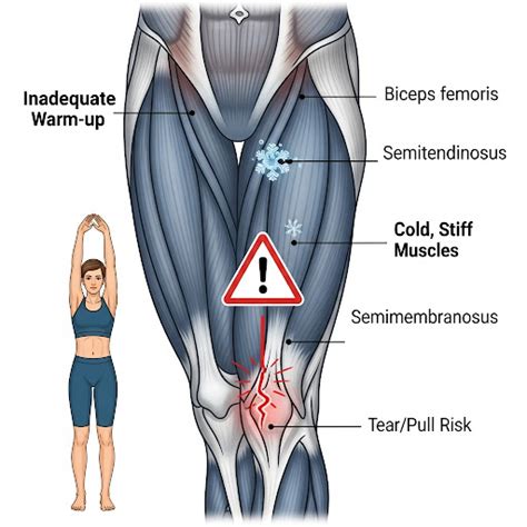 Massage For Hamstring Injuries Pulls Tears Tendonitis Tendinopathy