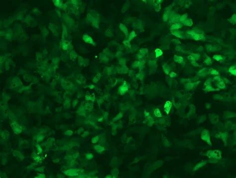 Mrna Transfection Of A Gfp Encoding Mrna Examined By Fluorescence