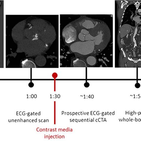 Computed Tomography Ct Imaging Protocol Timeline Illustrating The