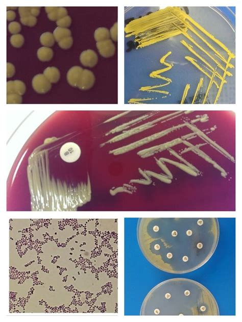 Micrococcus Luteus Negative Stain