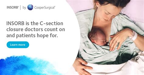 Insorb Absorbable Subcuticular Skin Stapler For Incisions Coopersurgical Medical Devices