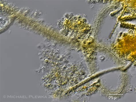 Freshwater And Other Micro Organisms From Germany Leptothrix Ochracea