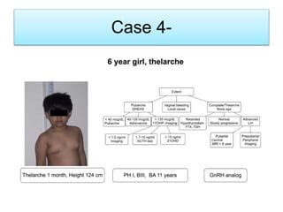 Precocious Puberty In Girl Approach And Management Pptx