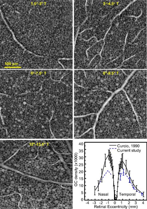 En Face Images Extracted From Gcl At Increasing Retinal Eccentricity Of Download Scientific