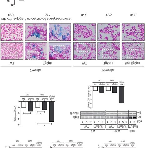Spi1 Induced Senescence Requires P38mapk14 Signaling In Hematopoietic