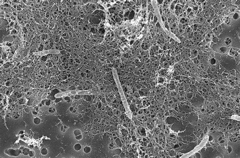 杆状细菌低倍显微镜杆状细菌白喉杆状细菌图片第2页大山谷图库