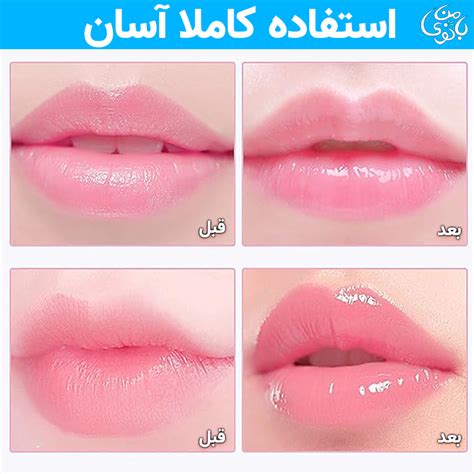 ماسک لب روشن کننده و آبرسان مدل زوزو Zozu بسته 20 عددی بانوی من