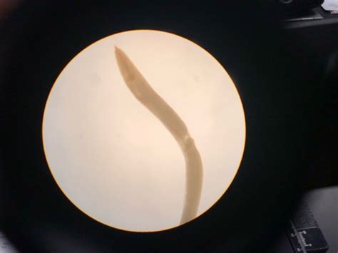 Phylum Nematoda Continued Flashcards Quizlet
