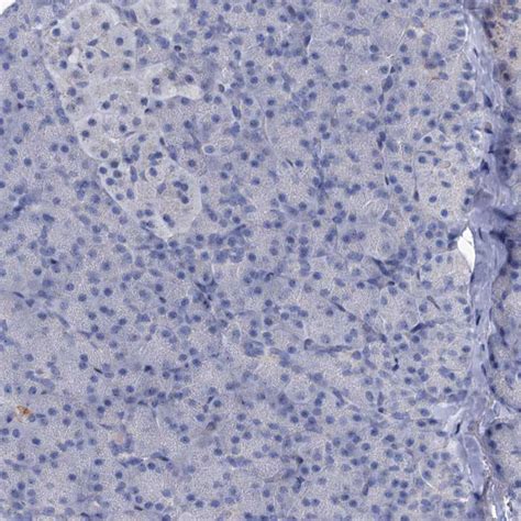 Glast Polyclonal Antibody Pa5 111080