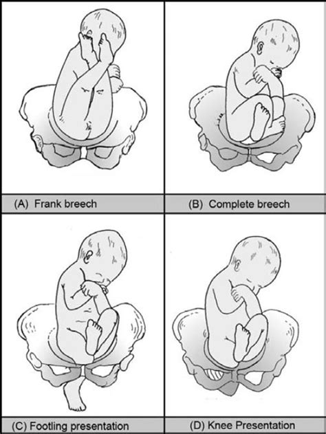Breech Types